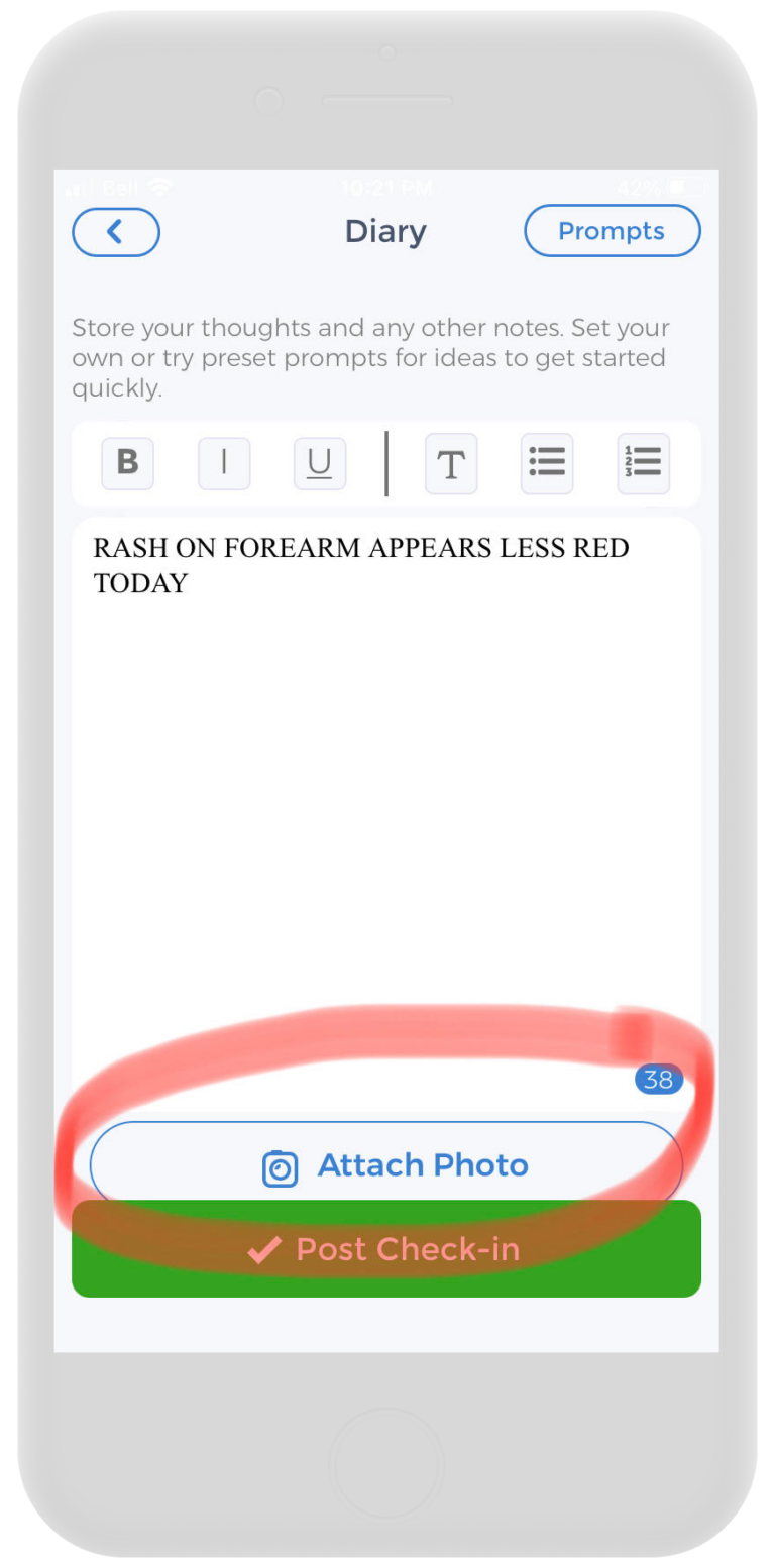 Ulcerative Colitis Skin Rash