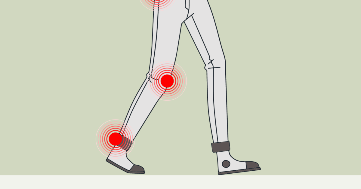 Sciatica Flare Up: Pinching of a Crucial Nerve