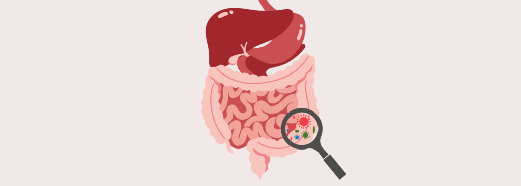 Living With Pancolitis: Tips for Managing Symptoms